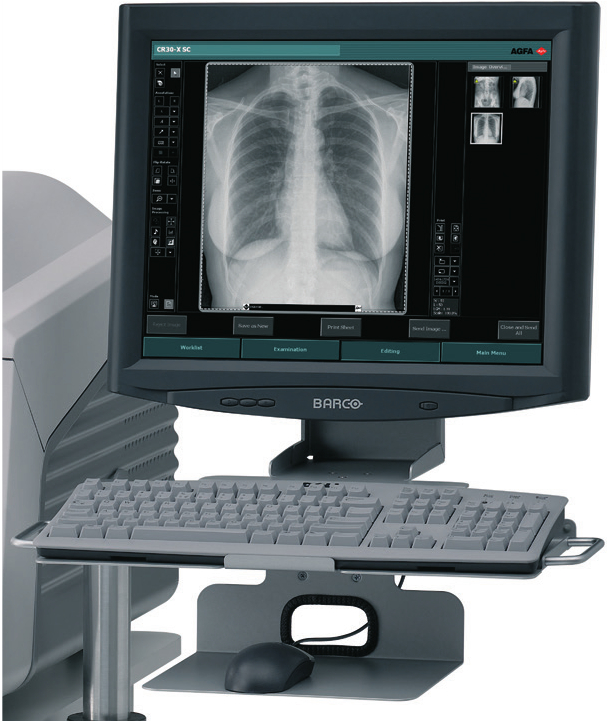 AGFA CR 30-X - Компактный настольный дигитайзер нового поколения